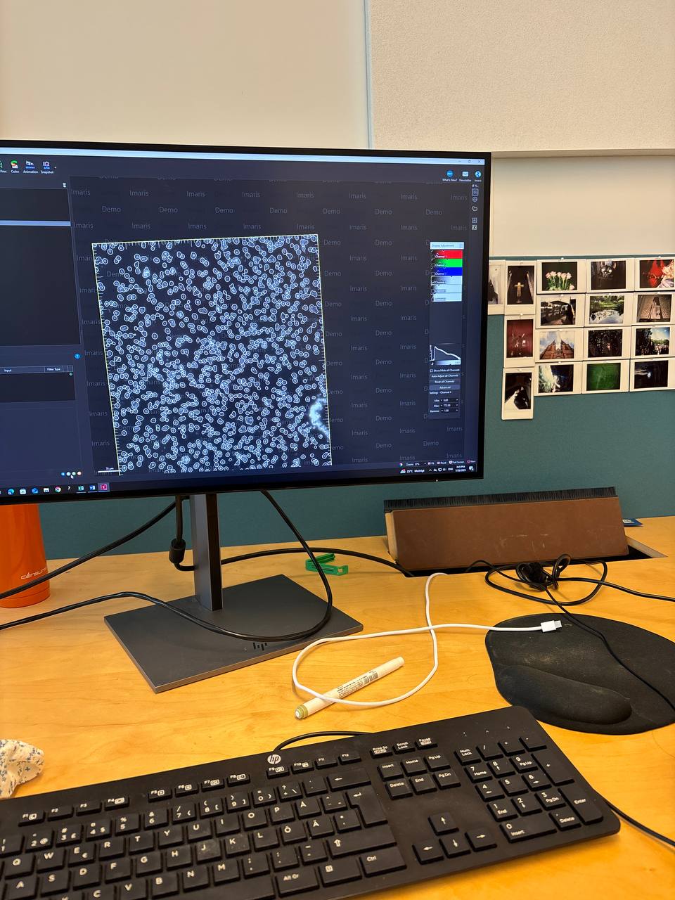 SciLifeLab Summer Internship for MSc Molecular Techniques in Life Sciences students - Student blogs