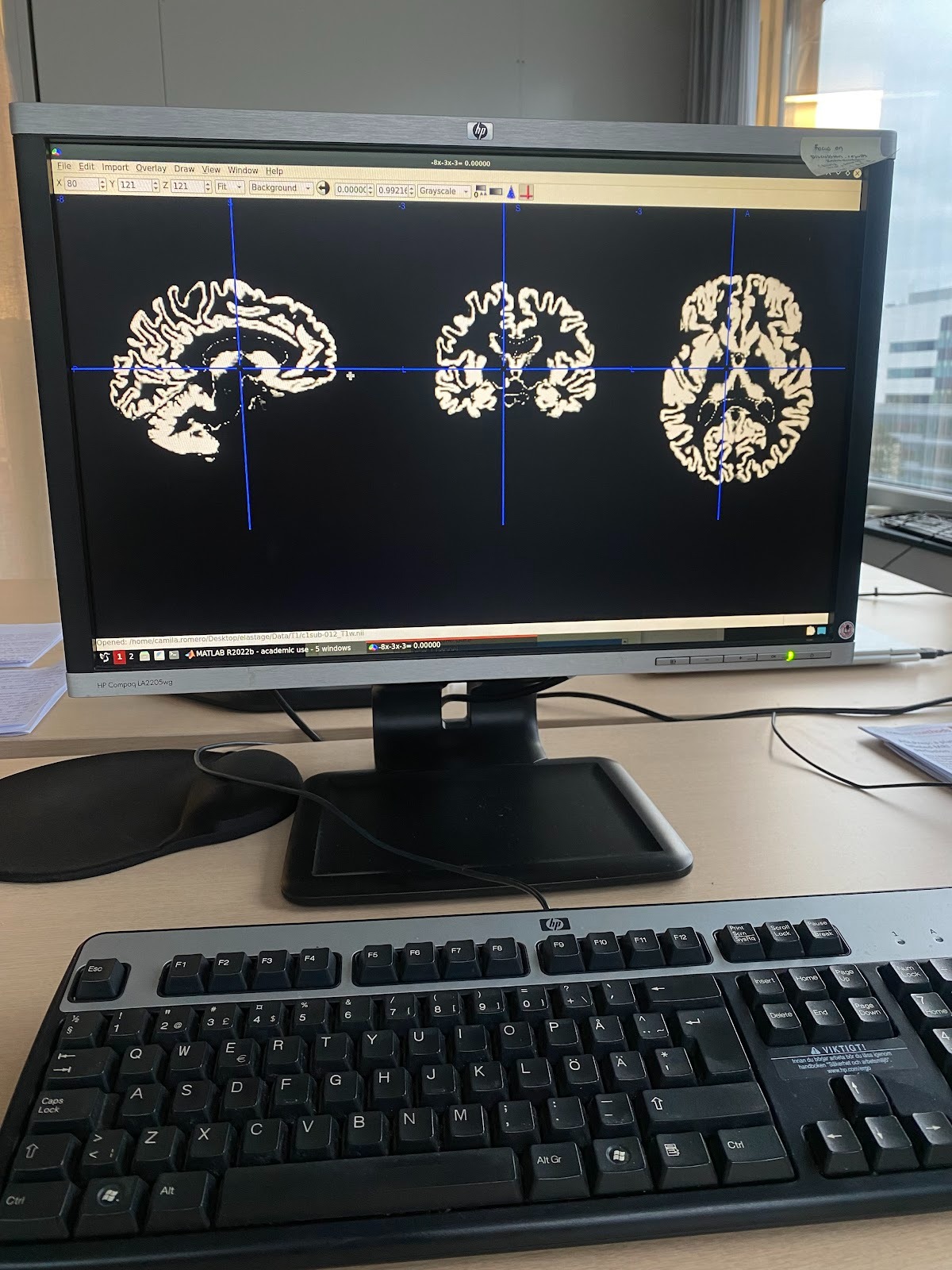 My experience across two research projects in the Translational ...